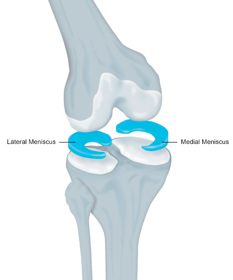 Meniscus Irritatie | Podotherapie Het Gooi